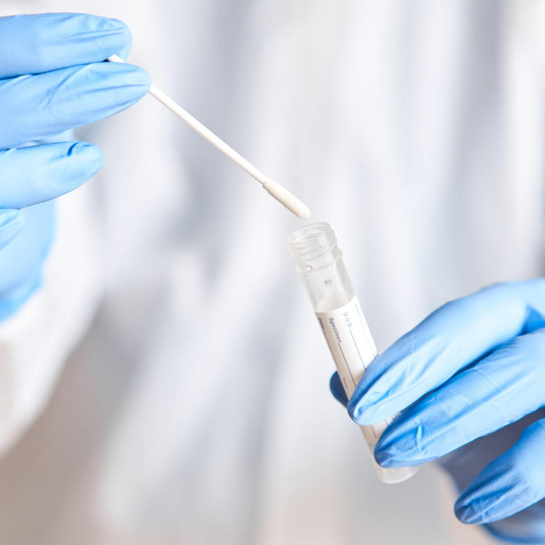 Real-Time PCR Test Now Available - Biorex Diagnostics - Primary ...