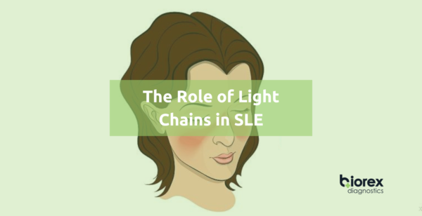 The Role of Light Chains in Systemic Lupus Erythematosus (SLE) - Biorex ...